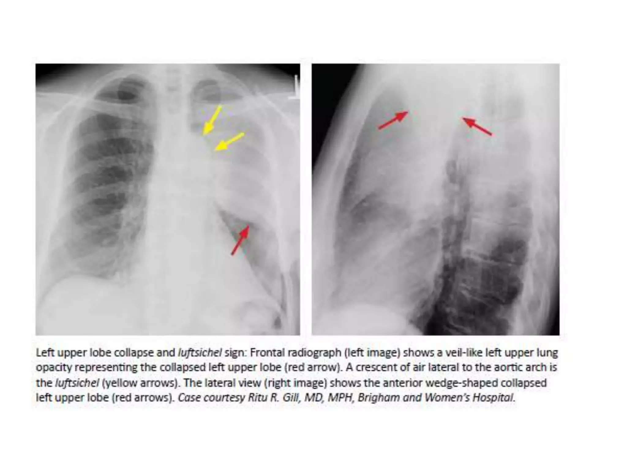 PAEDIATRIC RADIOLGOY.pptx