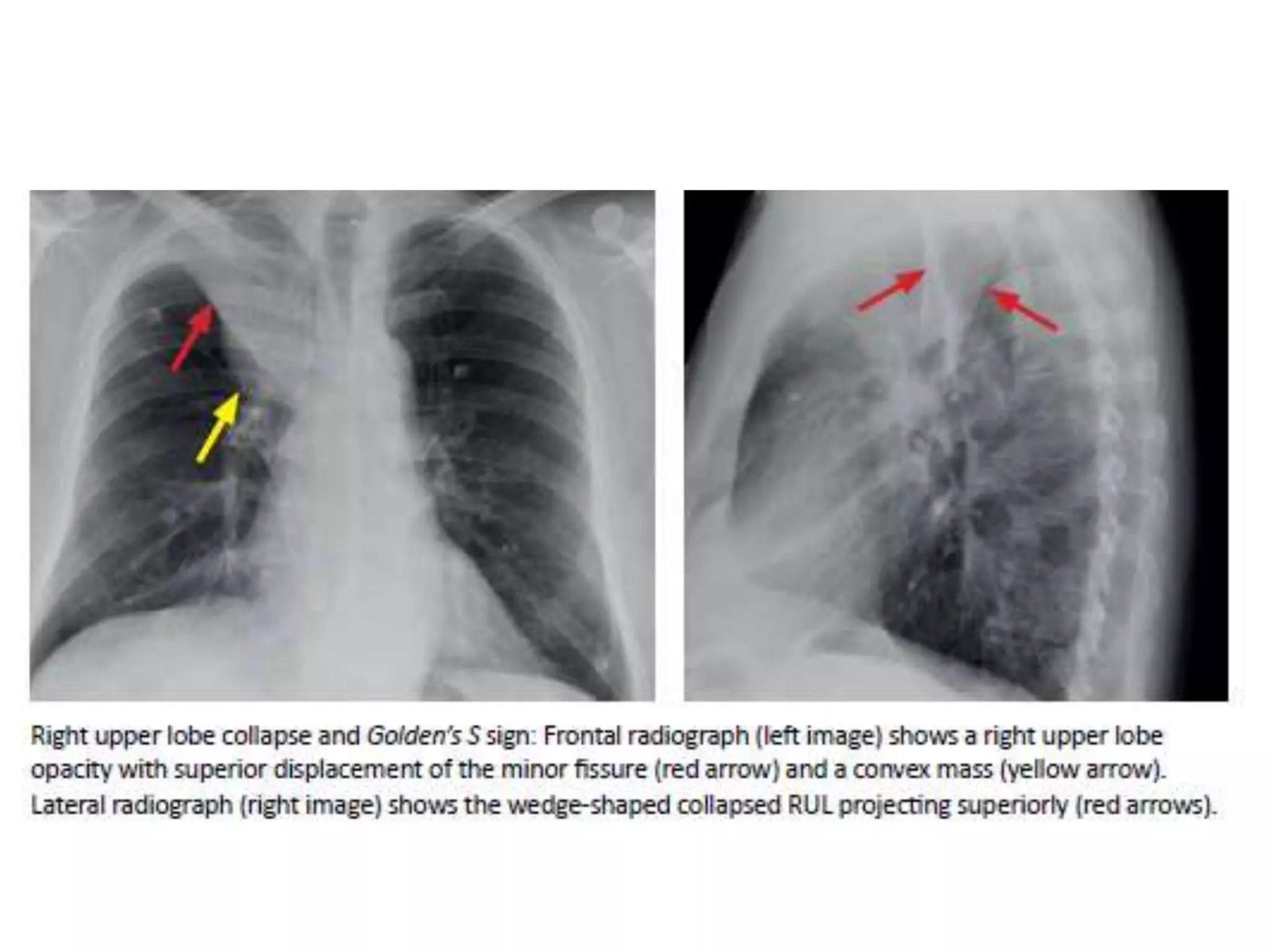 PAEDIATRIC RADIOLGOY.pptx