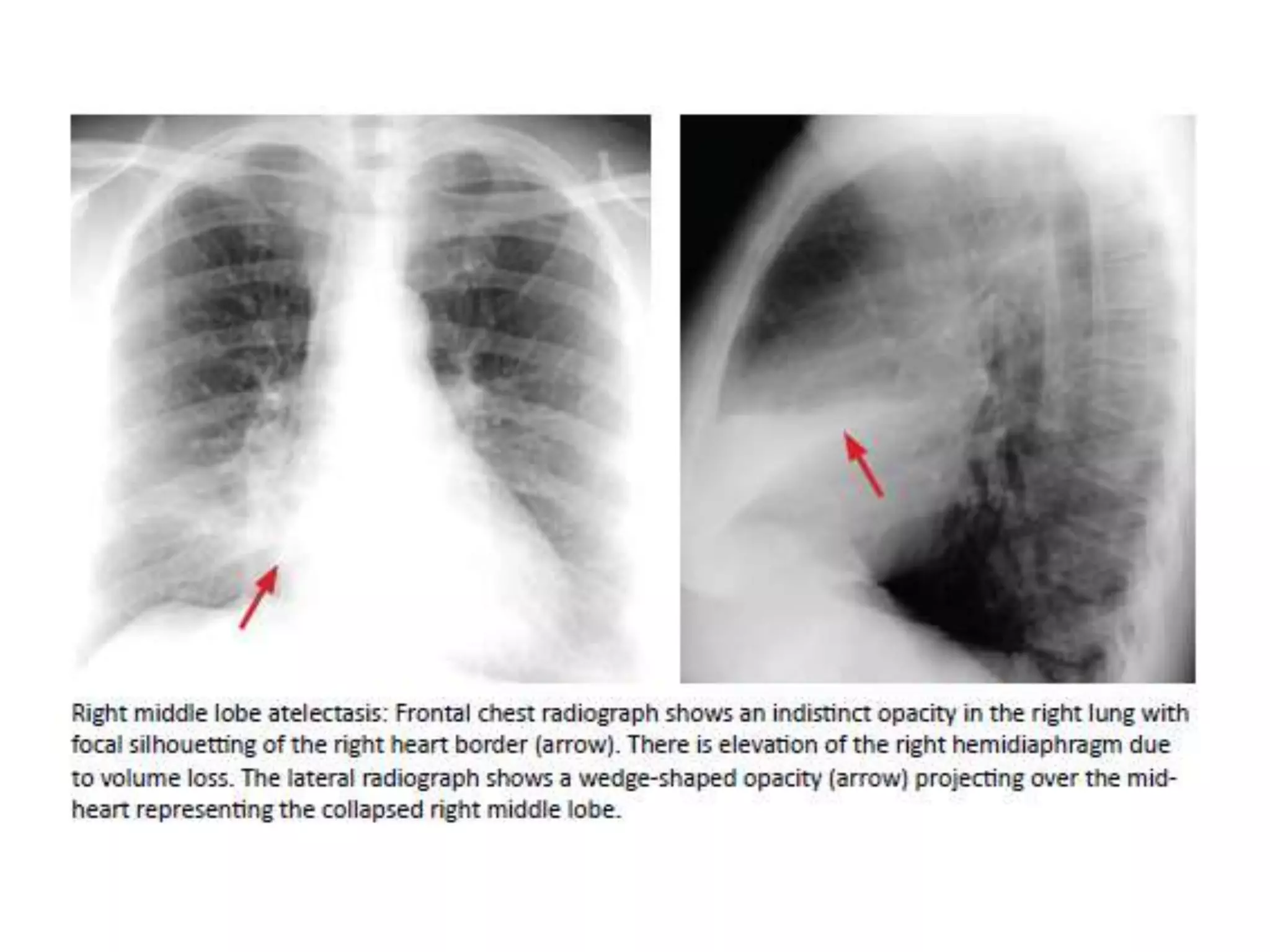 PAEDIATRIC RADIOLGOY.pptx