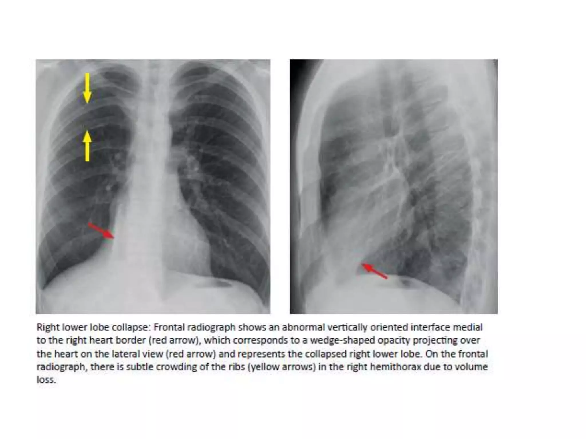 PAEDIATRIC RADIOLGOY.pptx