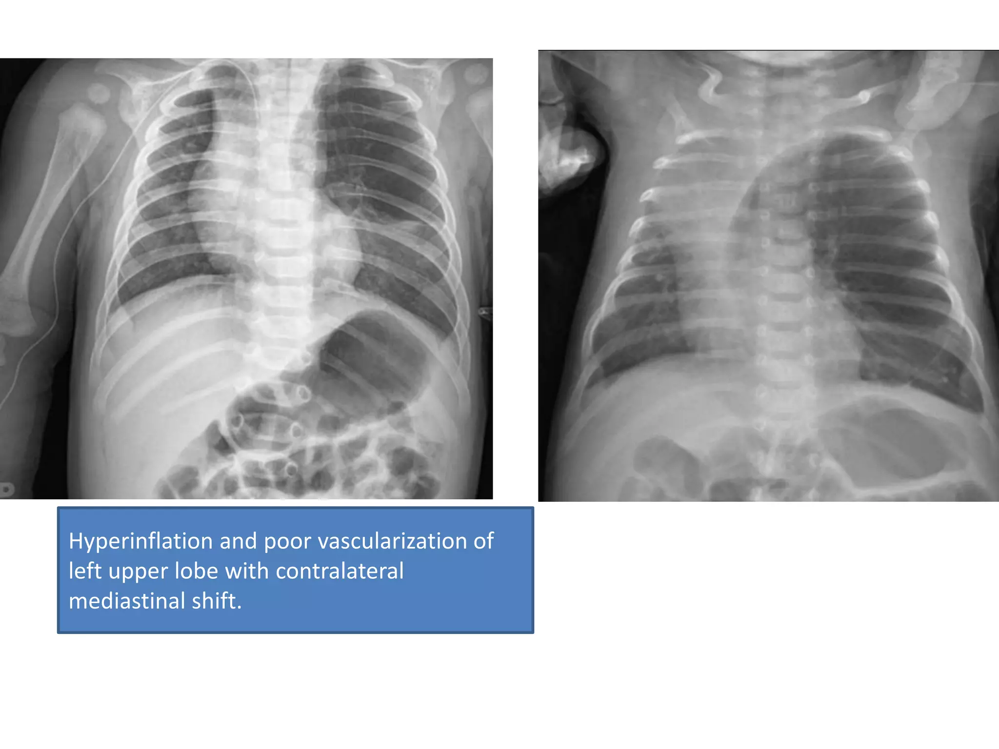 PAEDIATRIC RADIOLGOY.pptx