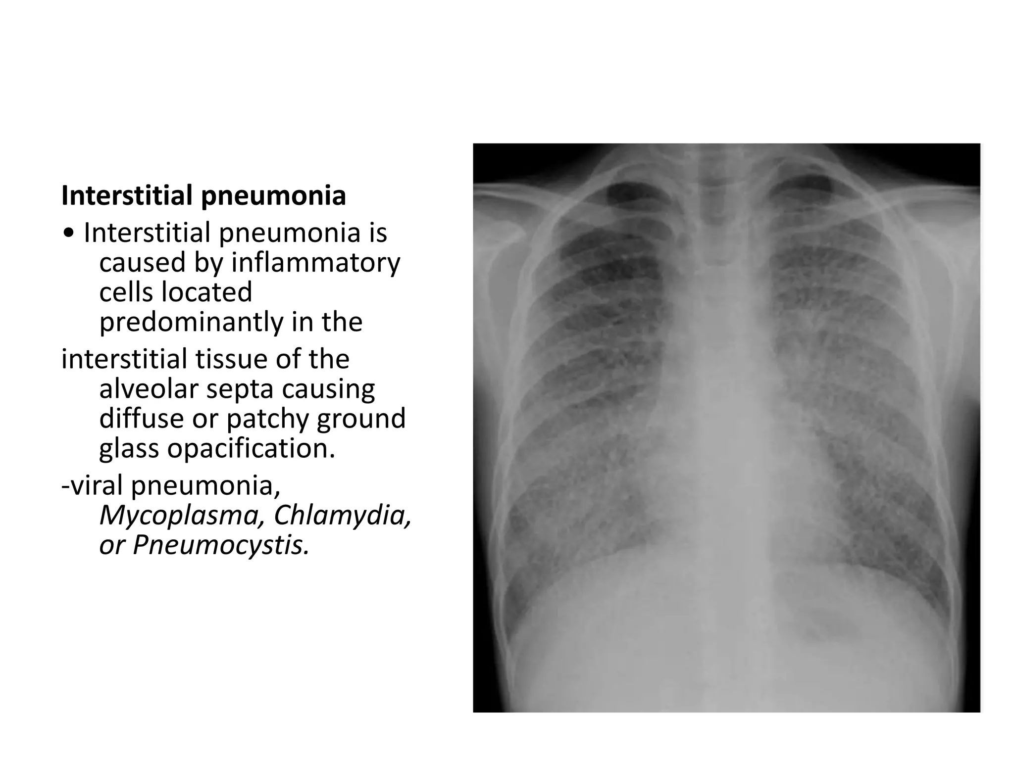 PAEDIATRIC RADIOLGOY.pptx