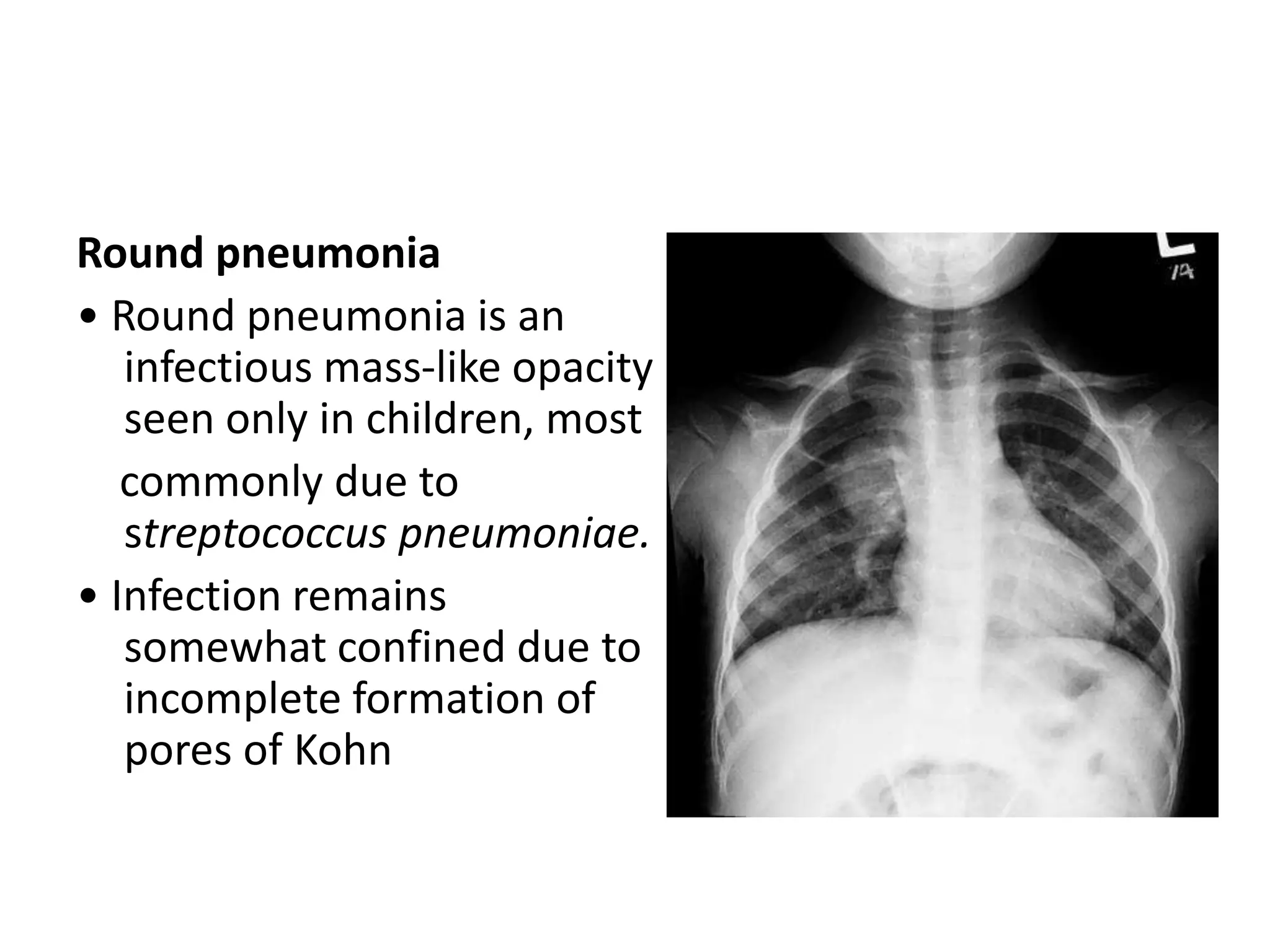 PAEDIATRIC RADIOLGOY.pptx