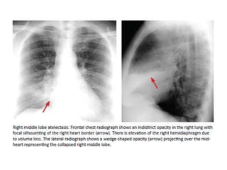 PAEDIATRIC RADIOLGOY.pptx