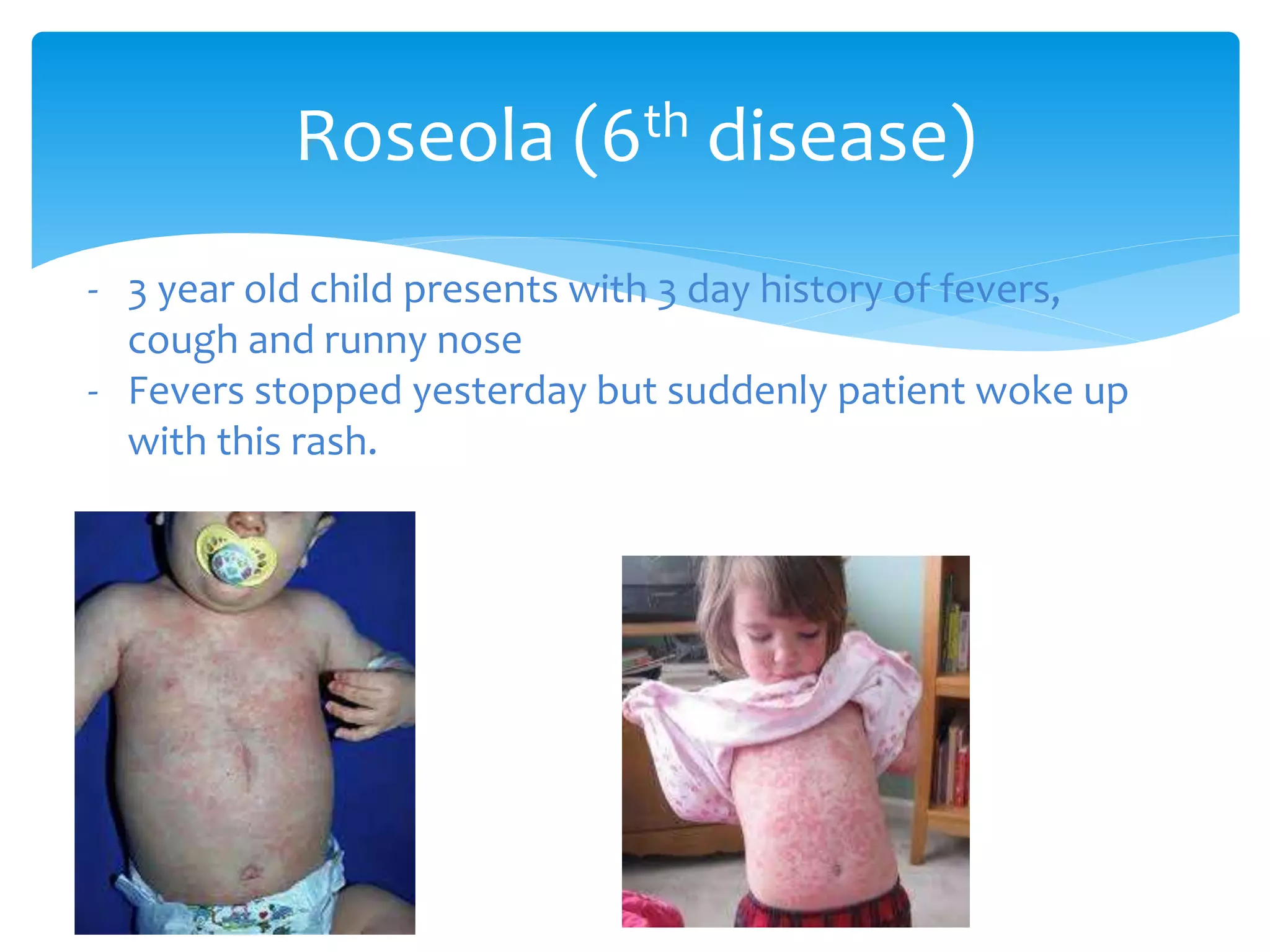 Paediatric rashes | PPTX