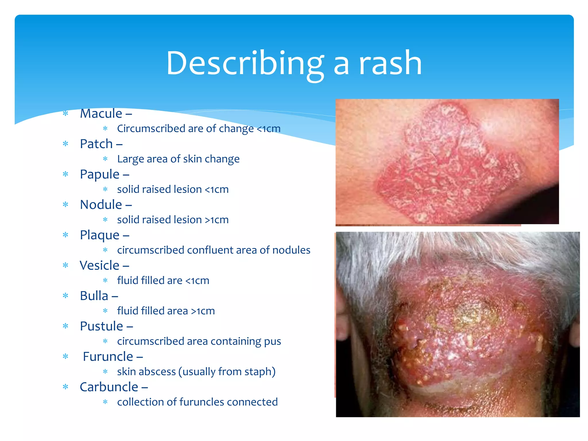 Paediatric rashes | PPTX