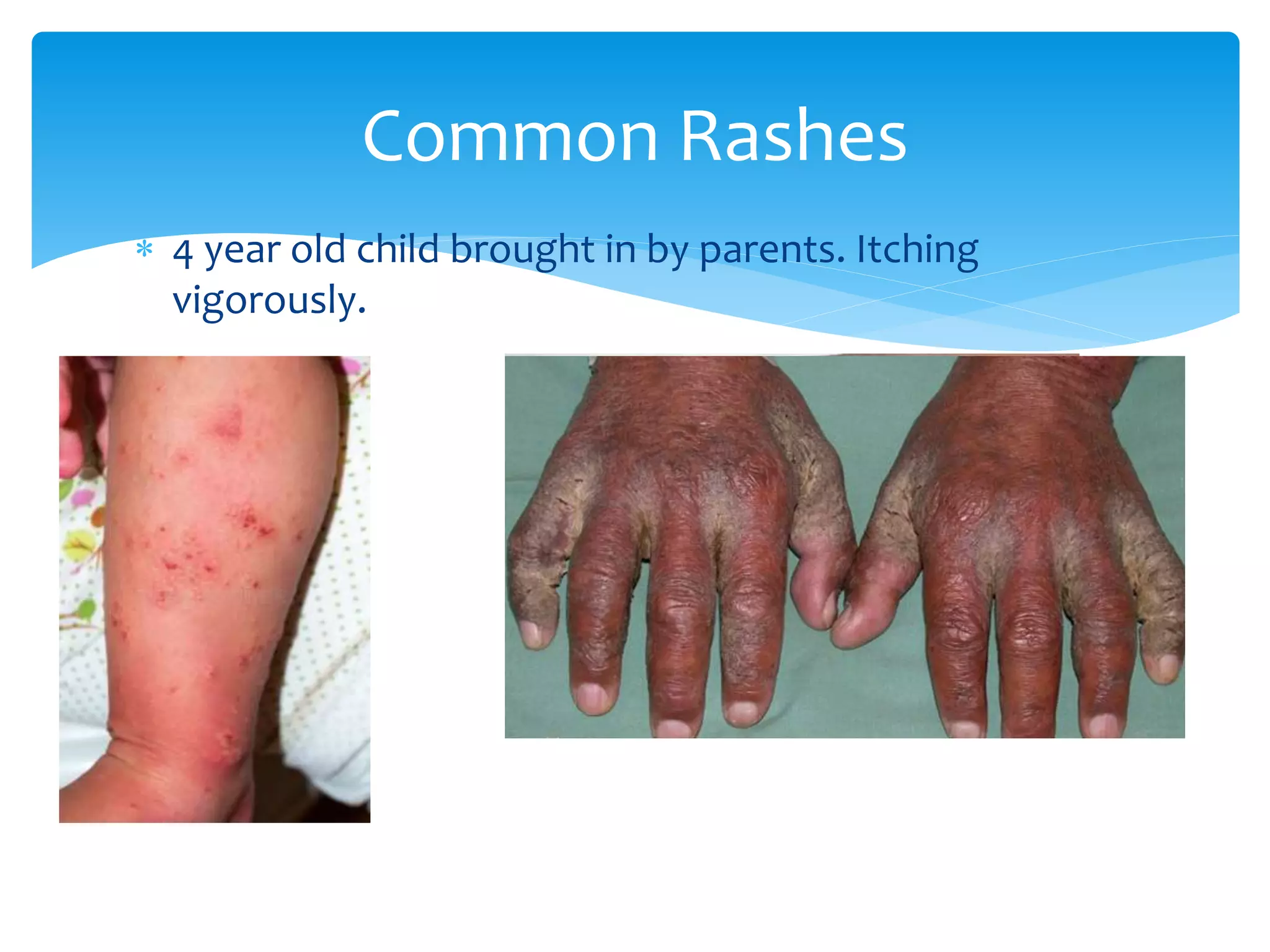 Paediatric rashes | PPTX