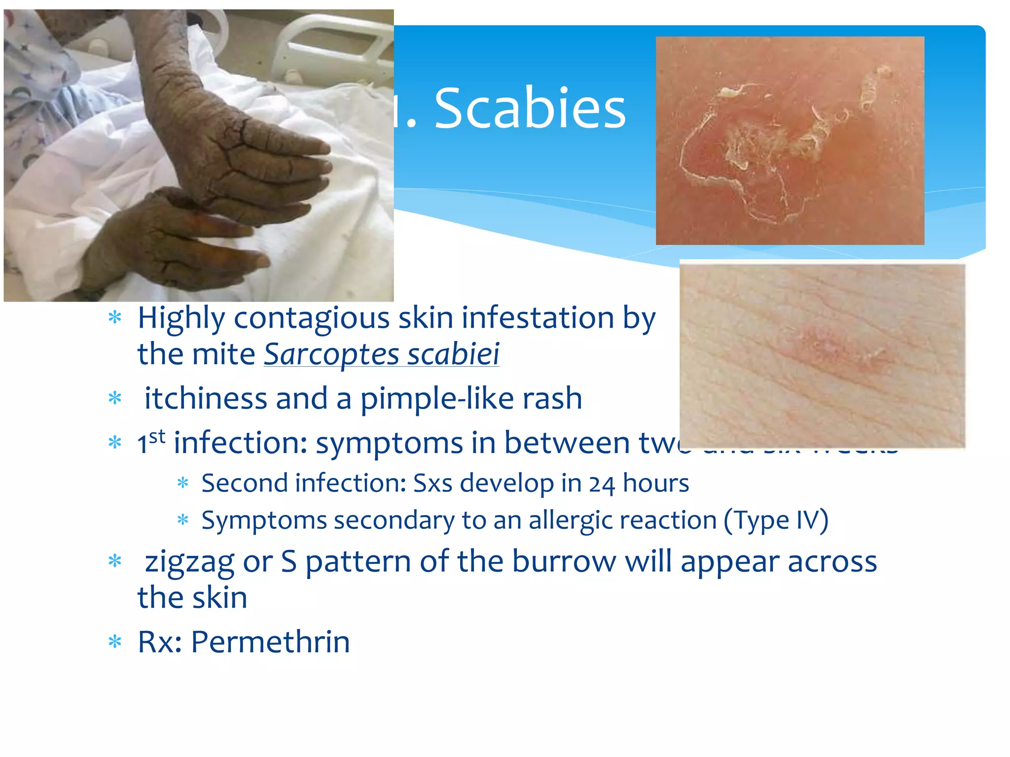 Paediatric rashes | PPTX | Infectious Diseases | Diseases and Conditions