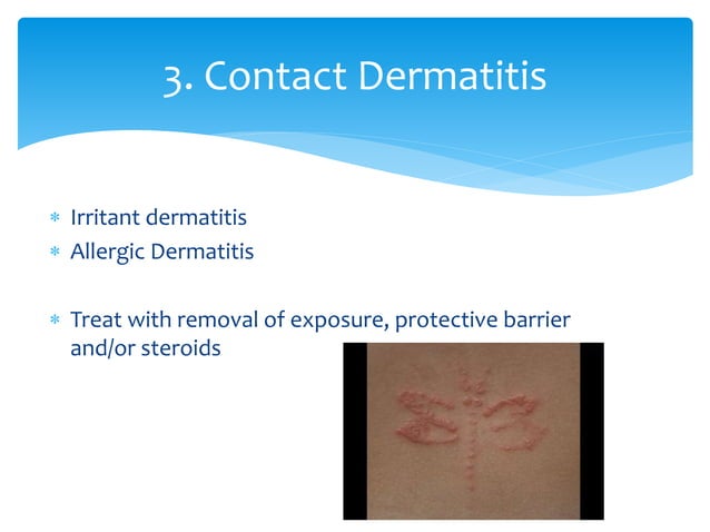 Paediatric rashes | PPT