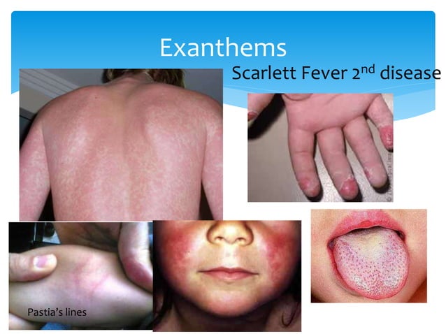 Paediatric rashes | PPTX | Infectious Diseases | Diseases and Conditions