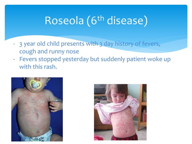 Paediatric rashes | PPTX | Infectious Diseases | Diseases and Conditions