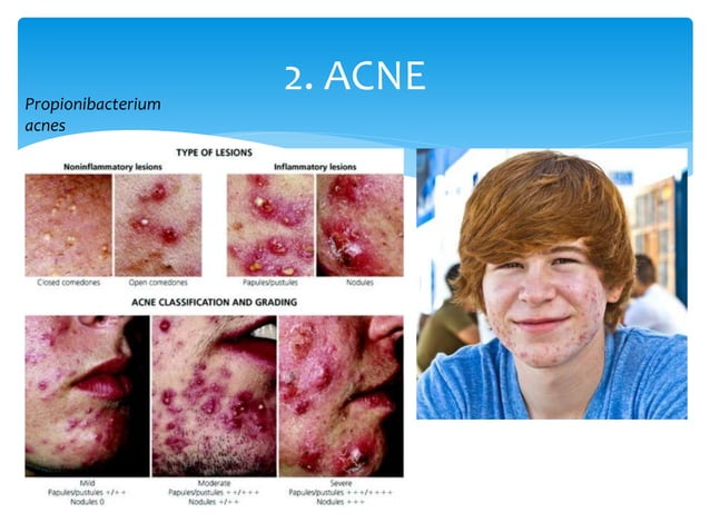 Paediatric rashes | PPTX | Infectious Diseases | Diseases and Conditions