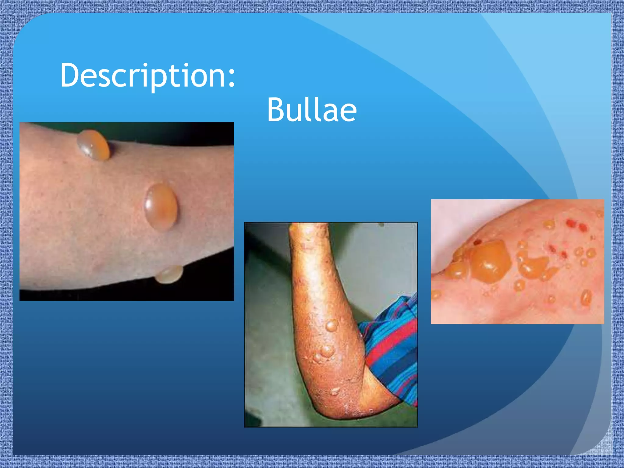 Paediatric Rashes | PPTX