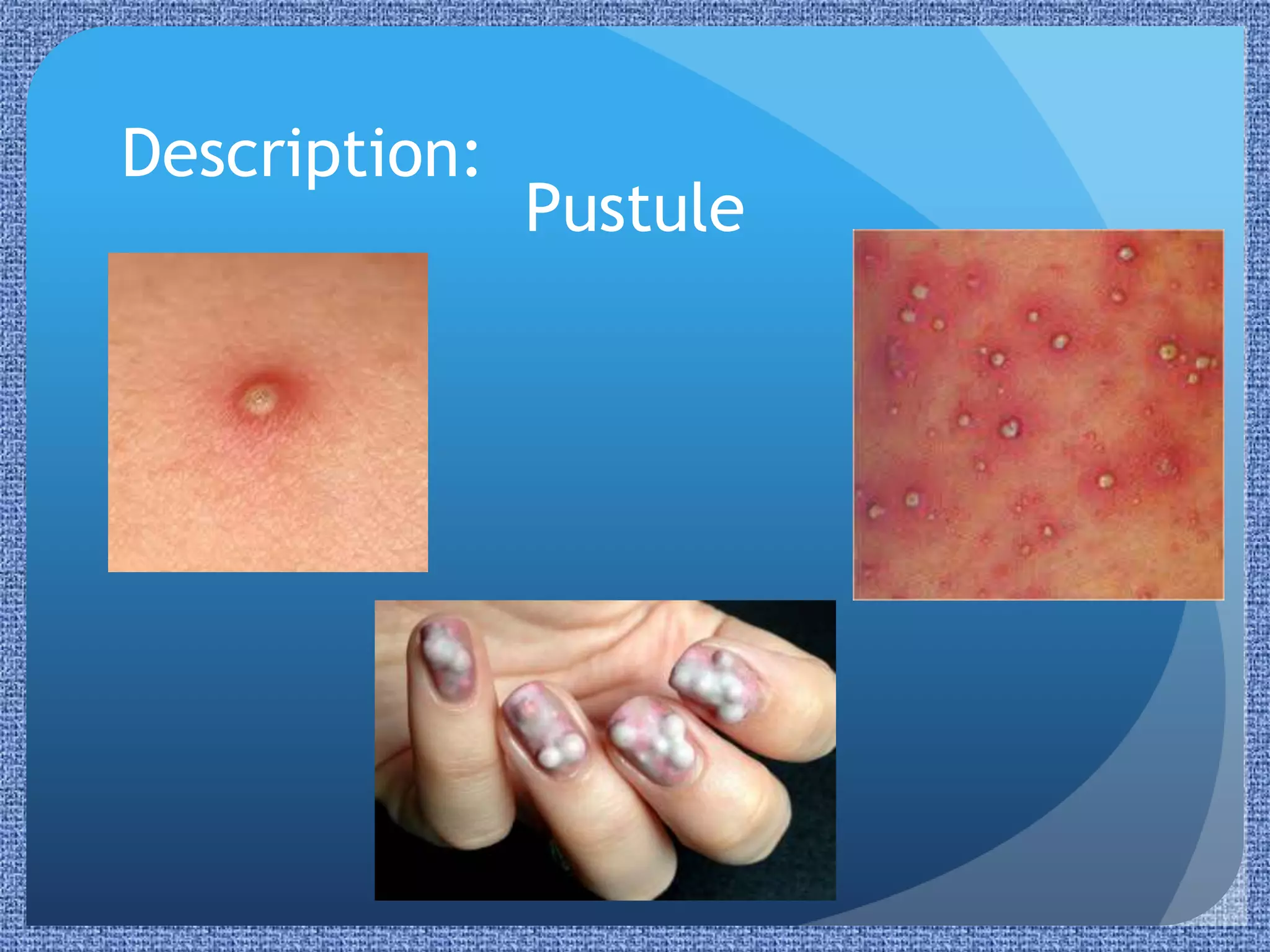 Paediatric Rashes | PPTX | Infectious Diseases | Diseases and Conditions