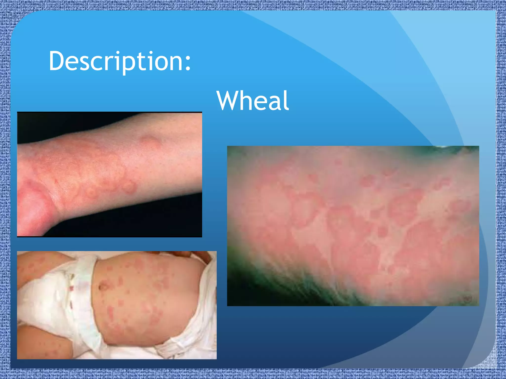 Paediatric Rashes | PPTX | Infectious Diseases | Diseases and Conditions
