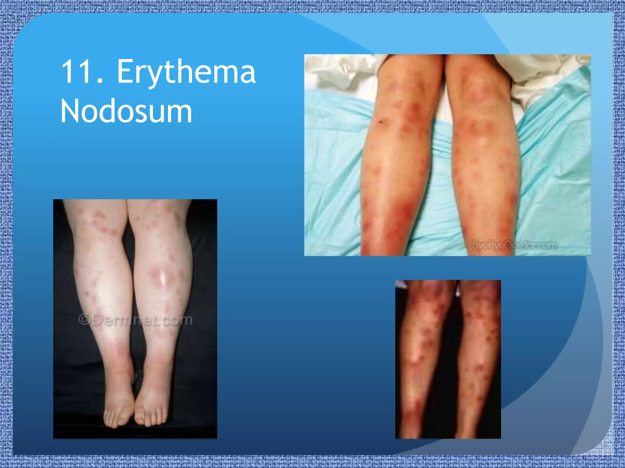 Paediatric Rashes | PPTX