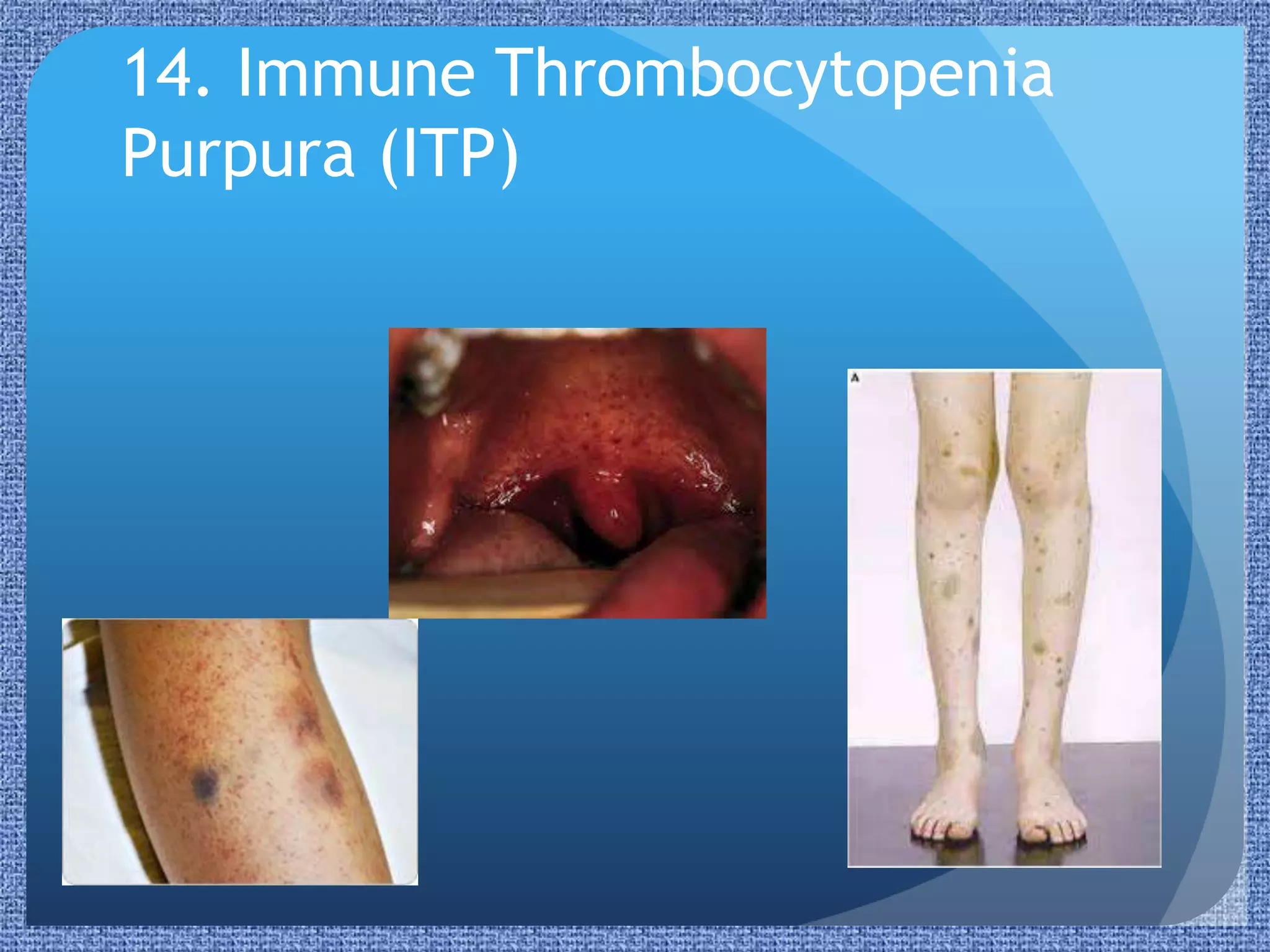 Paediatric Rashes | PPTX | Infectious Diseases | Diseases and Conditions