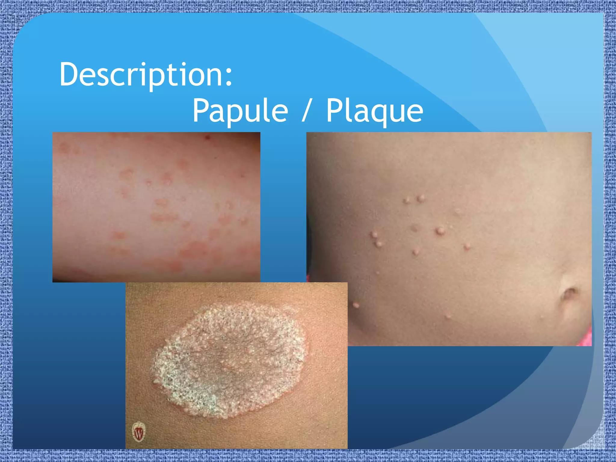 Paediatric Rashes | PPTX