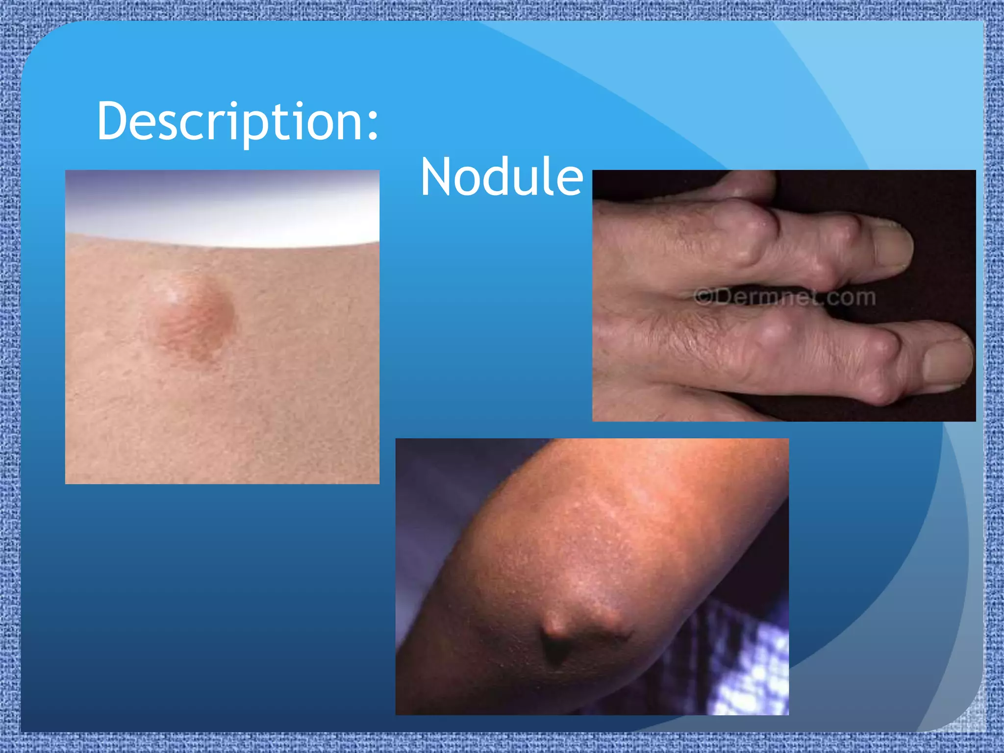 Paediatric Rashes | PPTX