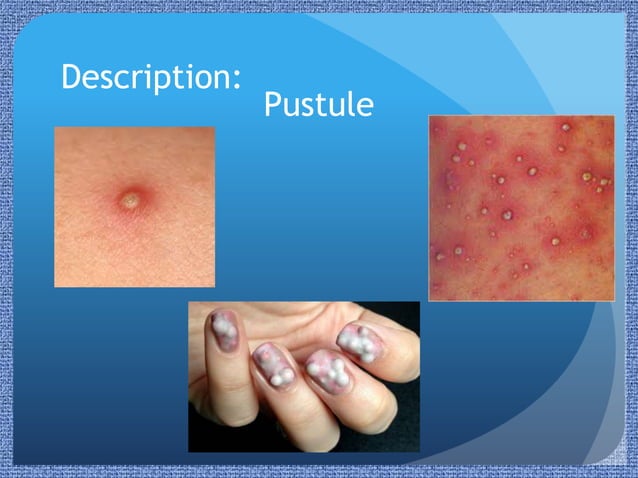 Paediatric Rashes | PPTX | Infectious Diseases | Diseases and Conditions