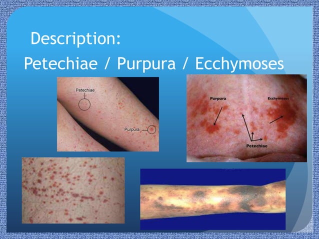 Paediatric Rashes | PPTX | Infectious Diseases | Diseases and Conditions