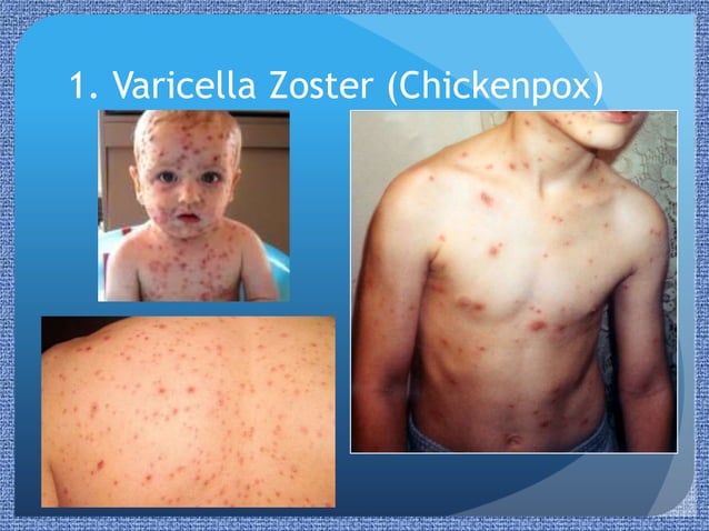 Paediatric Rashes | PPTX | Infectious Diseases | Diseases and Conditions