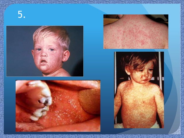 Paediatric Rashes | PPTX | Infectious Diseases | Diseases and Conditions