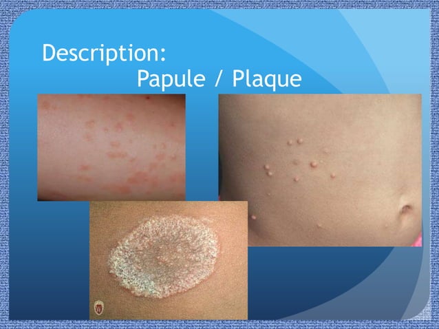 Paediatric Rashes | PPTX | Infectious Diseases | Diseases and Conditions