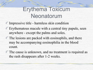 Erythema Toxicum