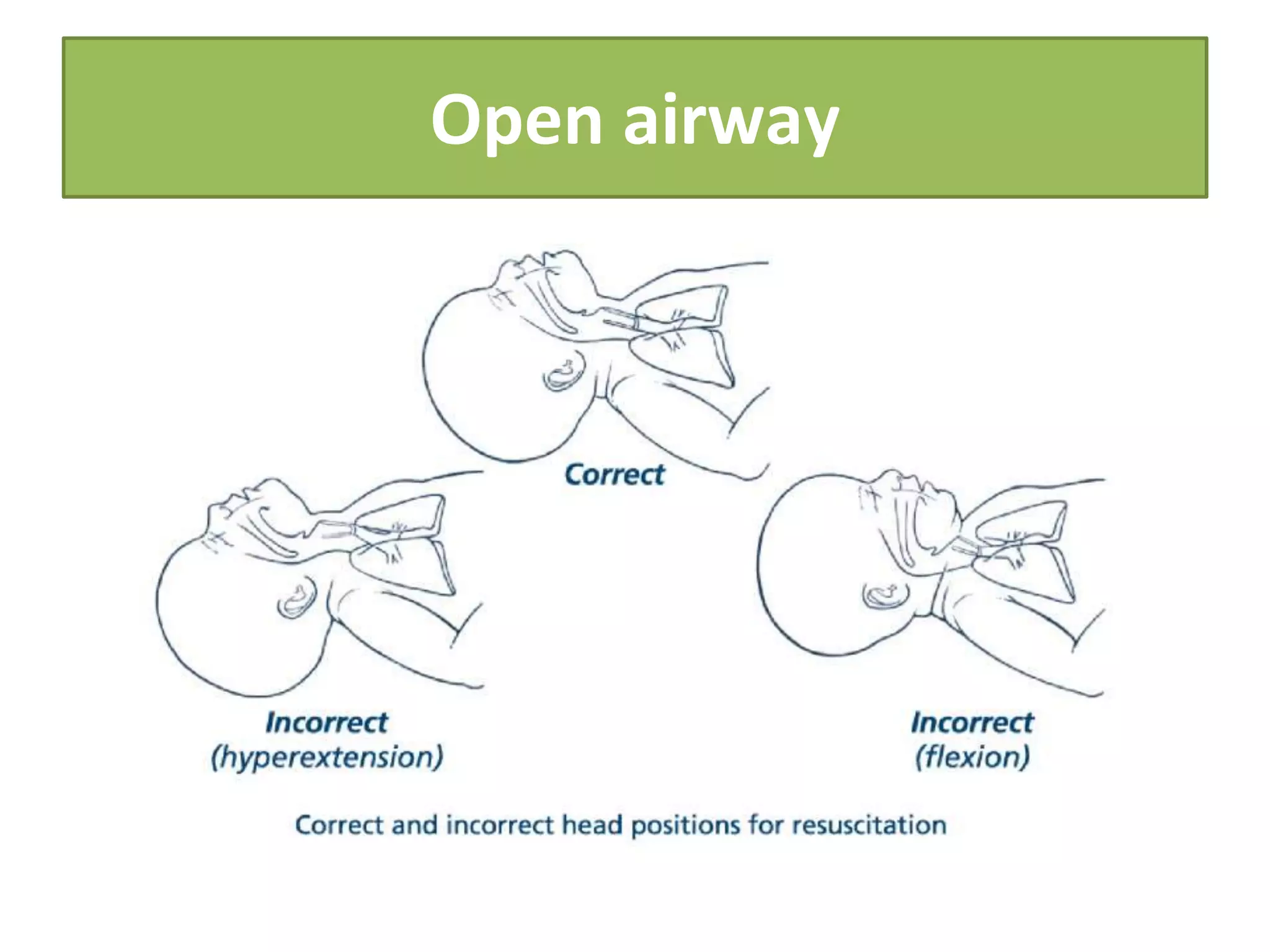 paediatric resuscitation..pptx