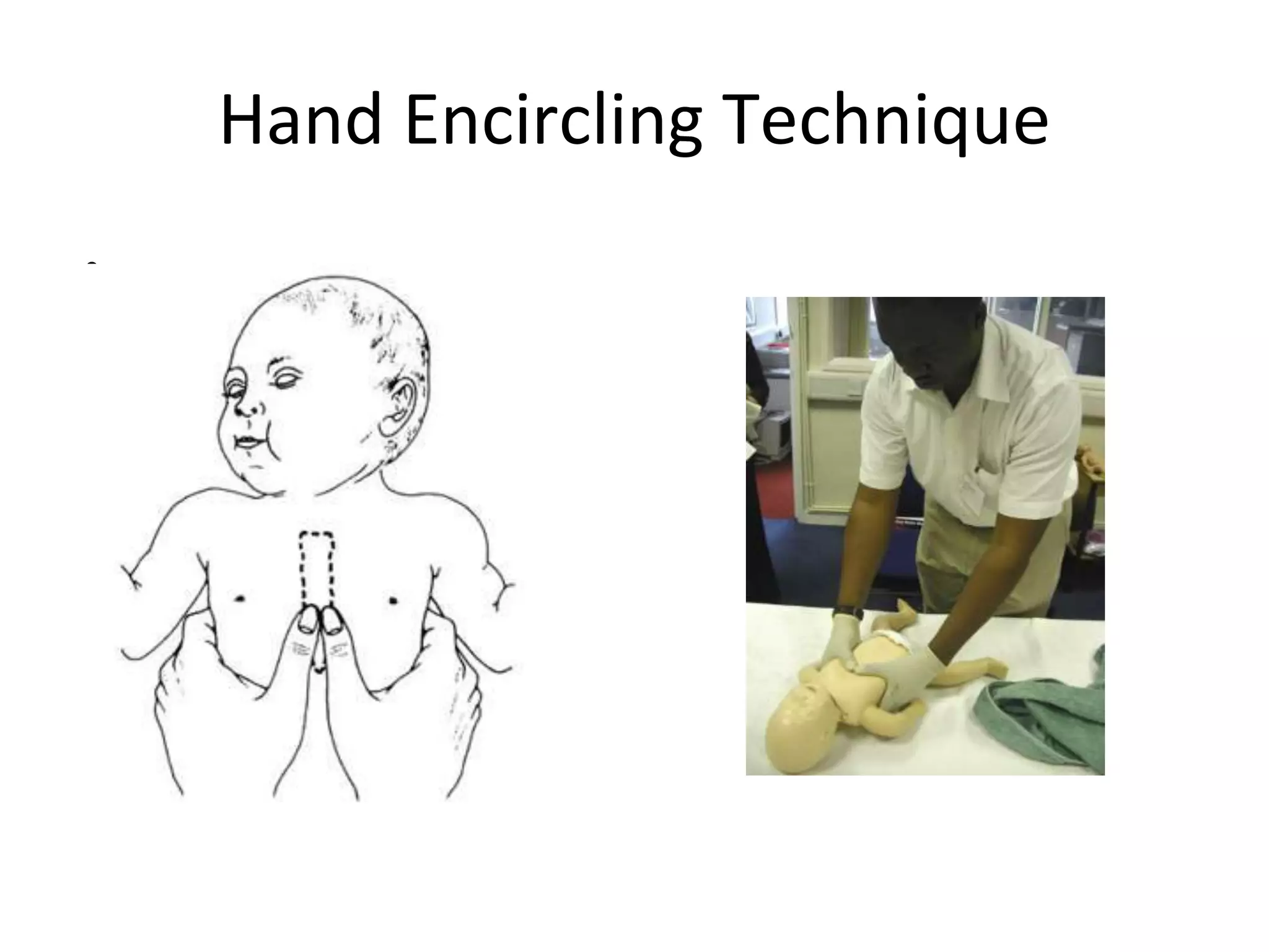paediatric resuscitation..pptx
