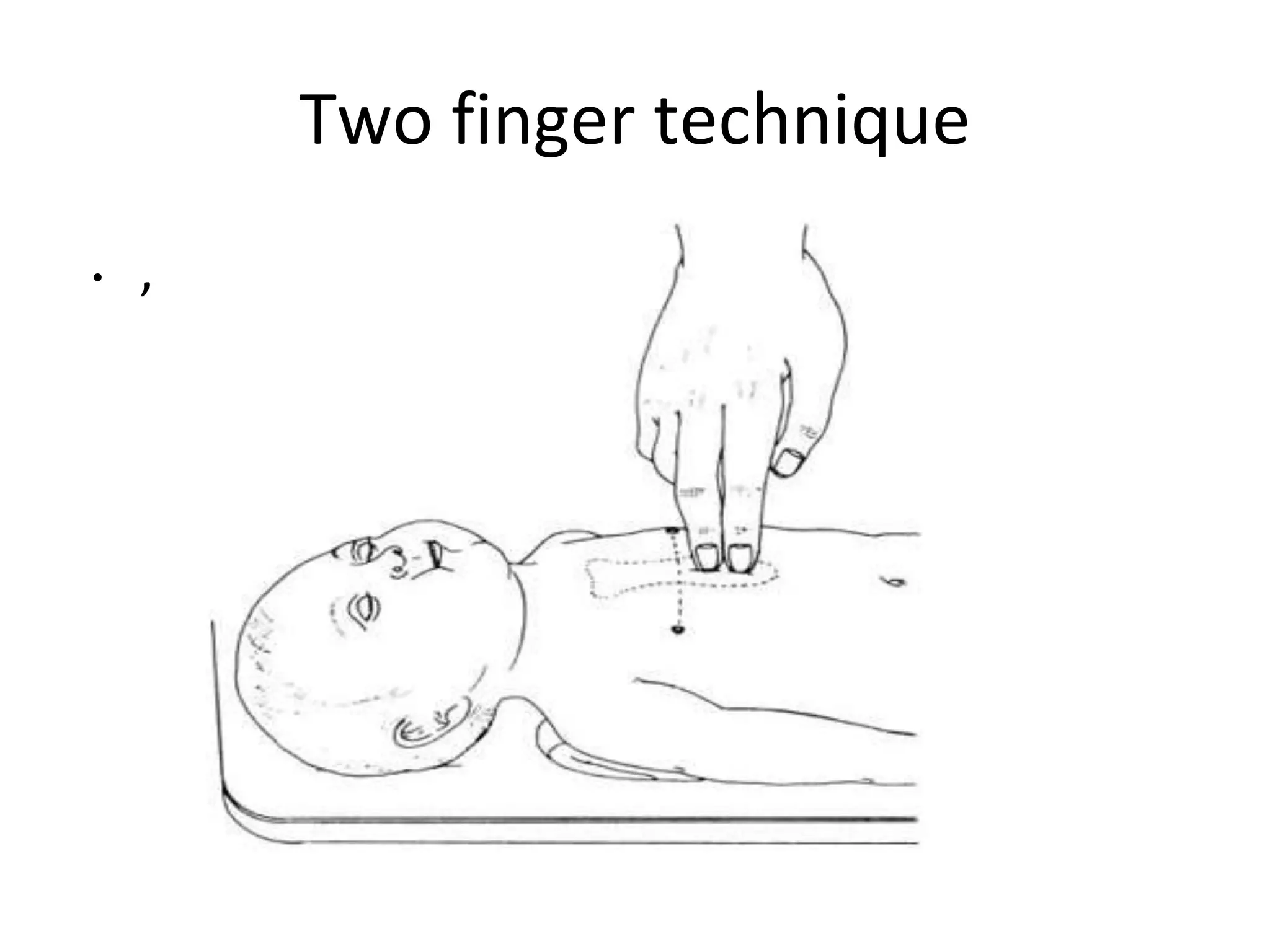 paediatric resuscitation..pptx