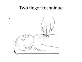 paediatric resuscitation..pptx