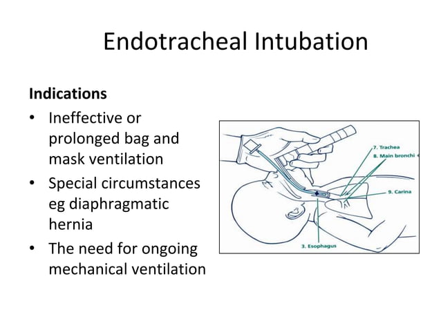 paediatric resuscitation..pptx