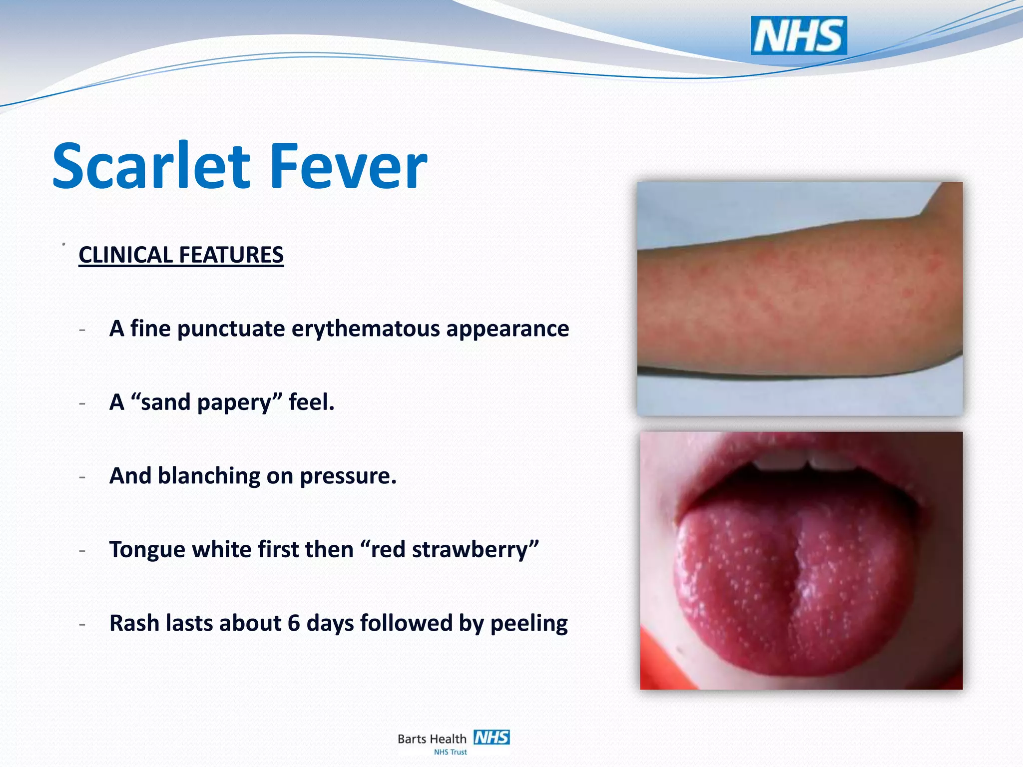 Paediatrics - Case presentation: fever+rash | PPTX