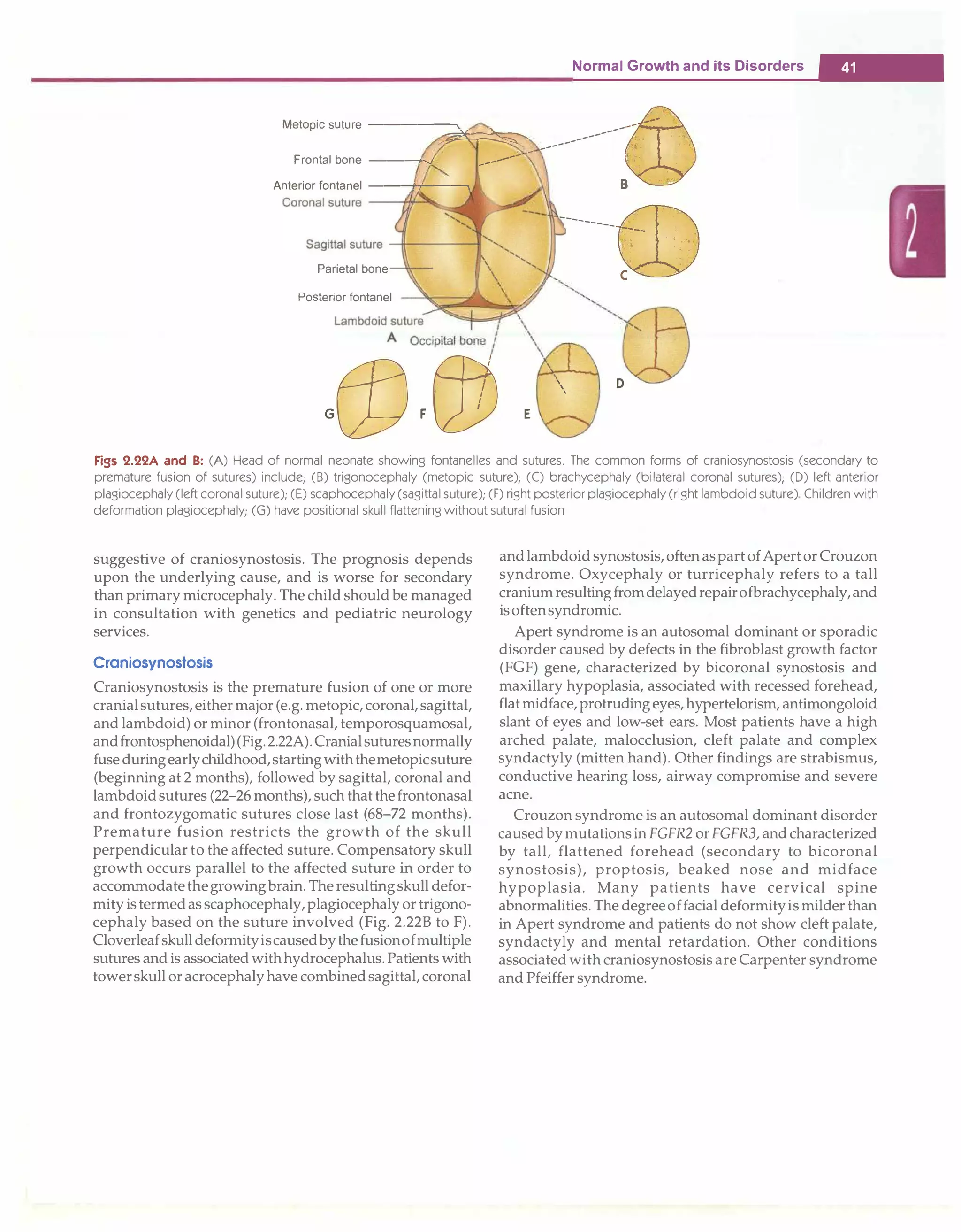 Paediatrics (8th Edition) [O.P. Ghai] .pdf