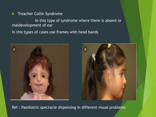 Glass prescription in children | PPTX