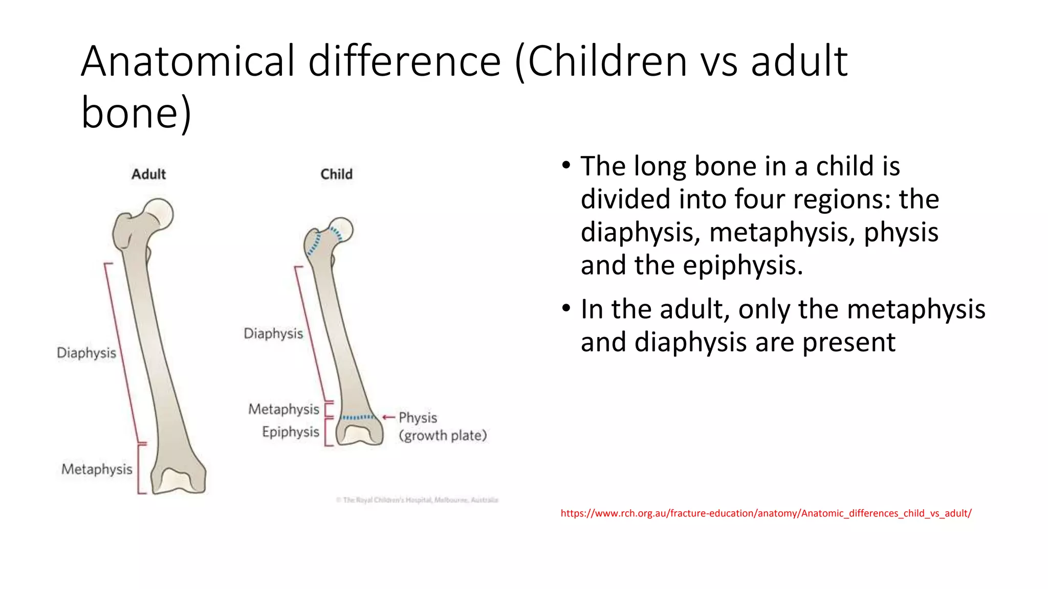 Paediatrics fracture | PPTX