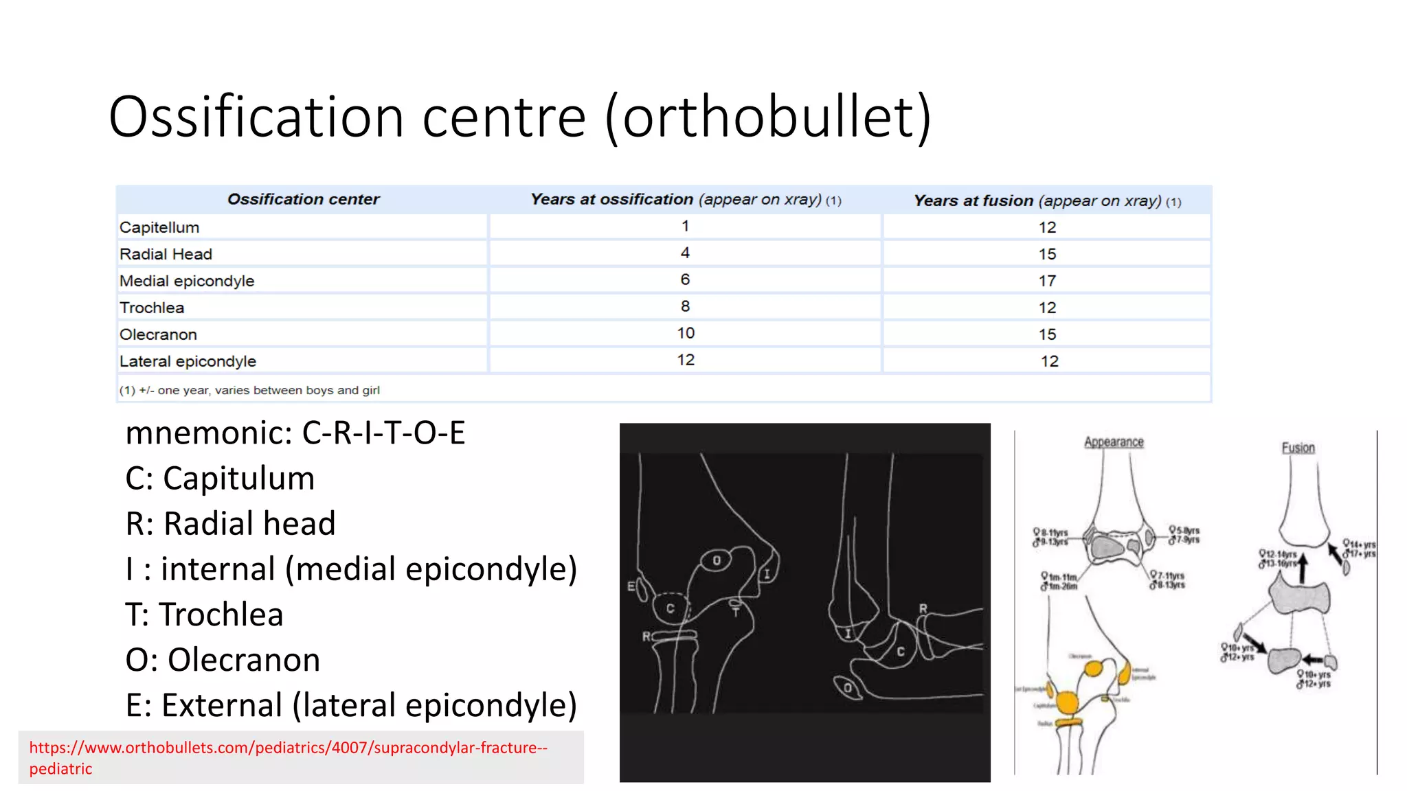 Paediatrics fracture | PPTX