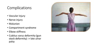 Paediatrics fracture | PPTX