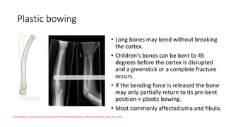 Paediatrics fracture | PPTX
