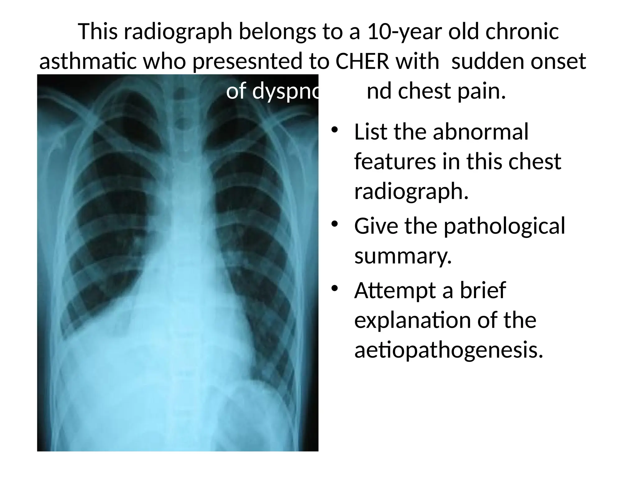 PAEDIATRICS OSCE FOR PART 3 MBBS PROFESSIONAL EXAMS pptx | PPTX