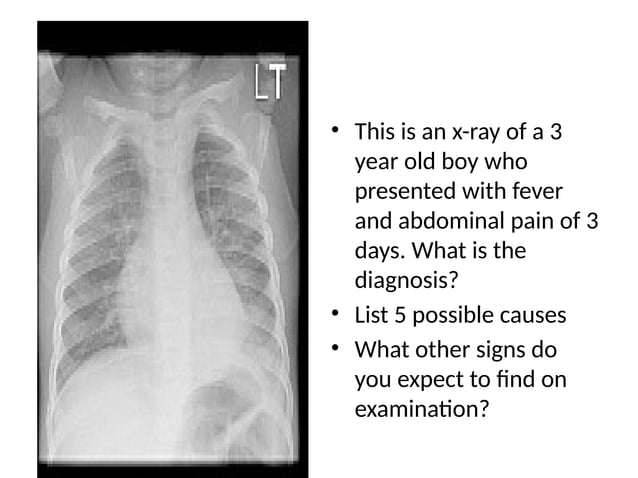 PAEDIATRICS OSCE FOR PART 3 MBBS PROFESSIONAL EXAMS pptx | PPTX