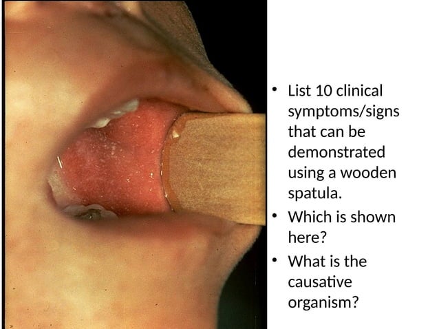 PAEDIATRICS OSCE FOR PART 3 MBBS PROFESSIONAL EXAMS pptx | PPTX