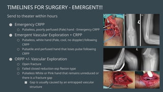 PAEDIATRIC SUPRACONDYLAR HUMERAL FRACTURES.pptx