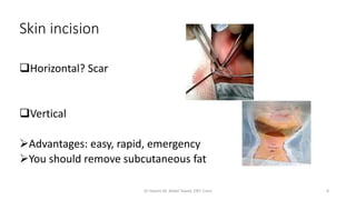 Paediatric tracheostomy | PPTX