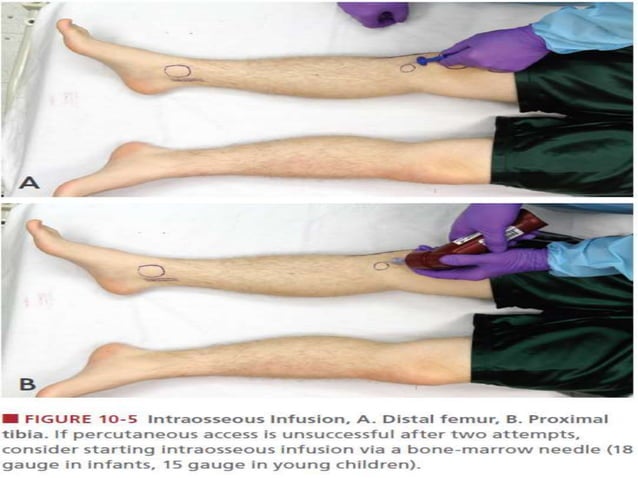 paediatric trauma.pptx | First Aid | Injuries
