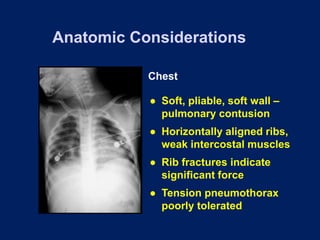 Paediatric Trauma.ppt