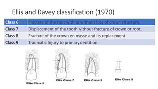 Paedo Lecture - Trauma to Anterior Teeth in Children.pdf