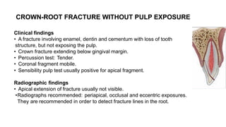 Paedo Lecture - Trauma to Anterior Teeth in Children.pdf